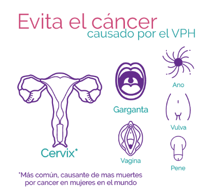 ¿Estan relacionados el Cáncer y el VPH? - Unidad Médica VPH